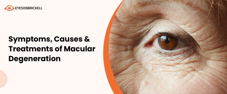 Macular Degeneration: Signs, Causes & Treatments | Eyes on Brickell
